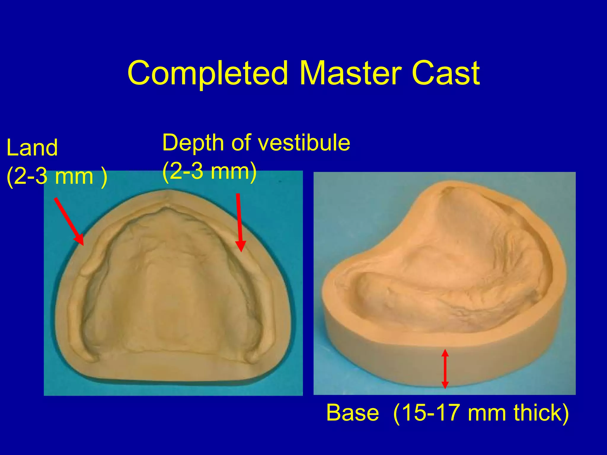 custom trays & master casts | PPT