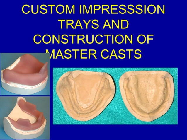 custom trays & master casts | PPT | Oral care | Personal Care