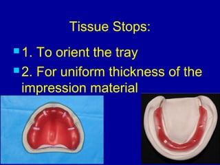 custom trays & master casts | PPT