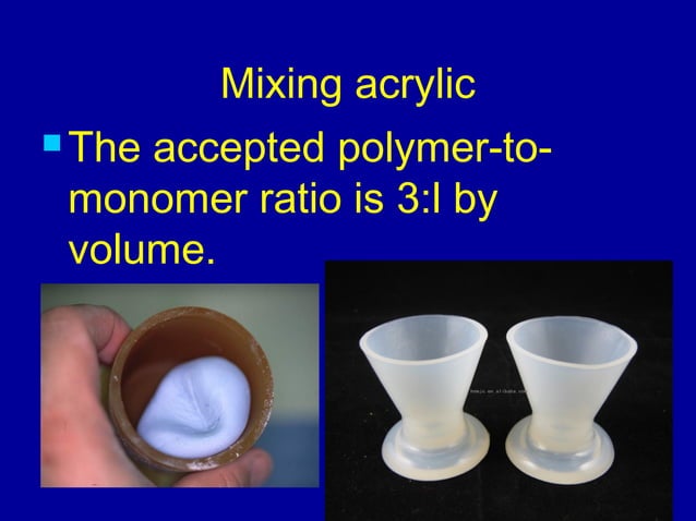 custom trays & master casts | PPT | Oral care | Personal Care