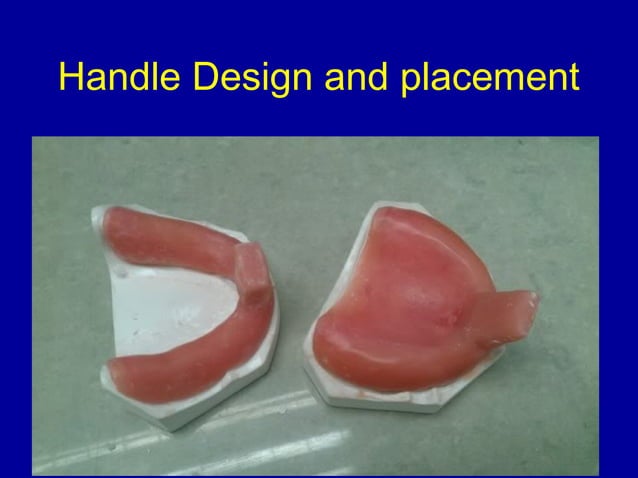 custom trays & master casts | PPT | Oral care | Personal Care