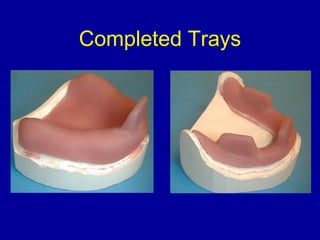 custom trays & master casts | PPT