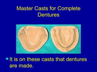 custom trays & master casts | PPT