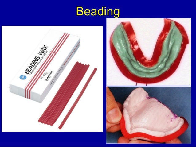 custom trays & master casts