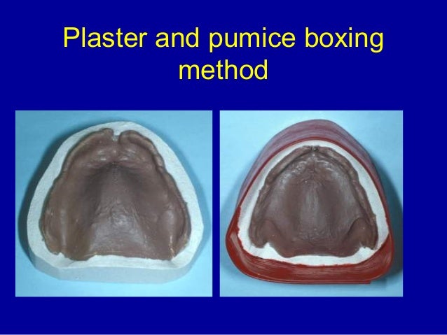 custom trays & master casts
