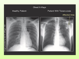 Types of Screening | PPT