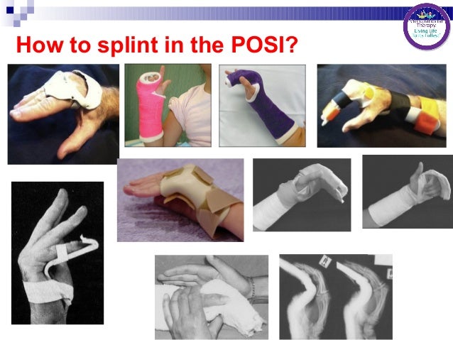 4.position of safe immobilisation