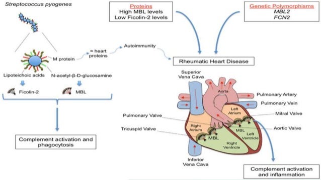 Streptococcus Group A Rheumatic Fever