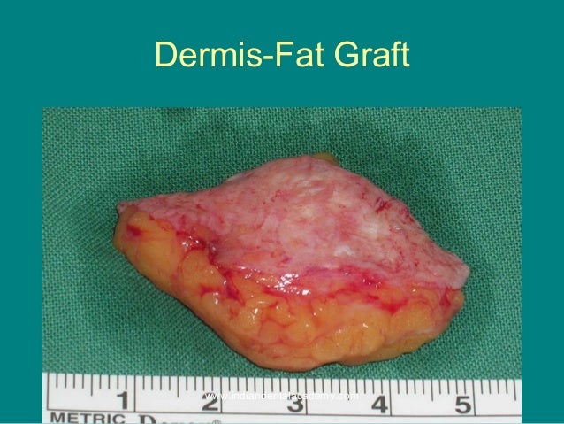 tmj surgical techniques/cosmetic dentistry courses