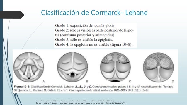 4. VIA AEREA Y ANESTESIA