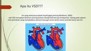 ASKEP VENTRICULAR SEPTAL DEFECT (VSD) | PPTX