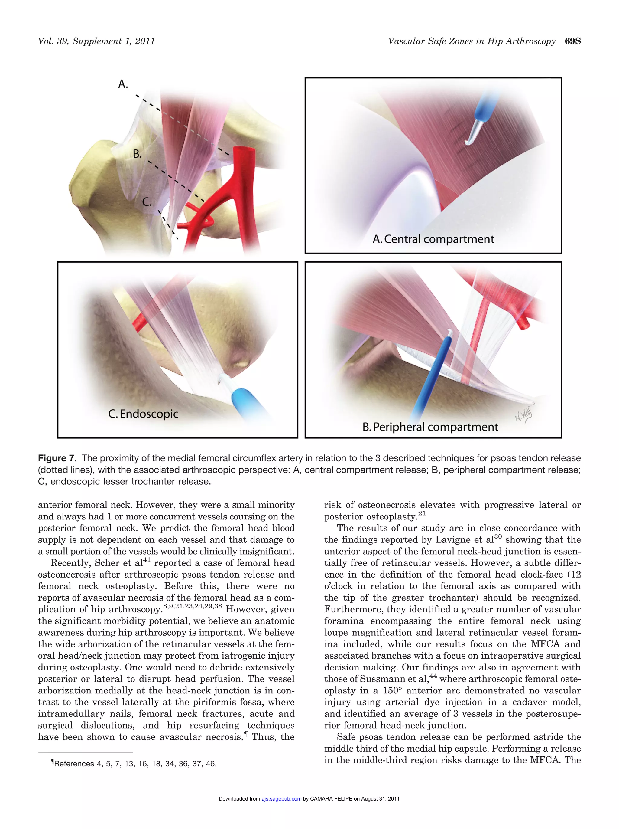 vascular safe zones in hip arthroscopy | PDF