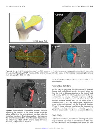 vascular safe zones in hip arthroscopy | PDF