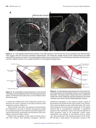 vascular safe zones in hip arthroscopy | PDF