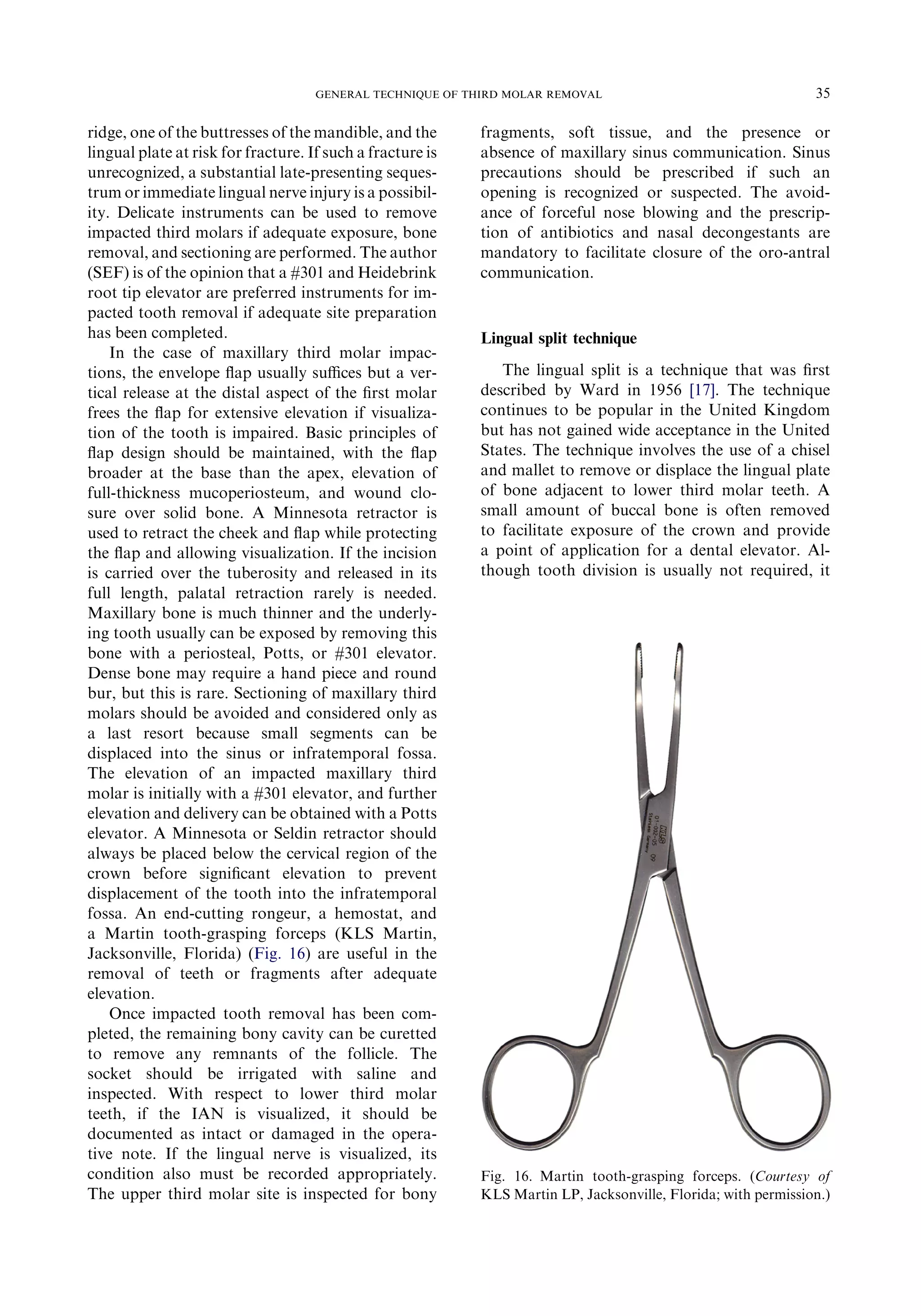 General Technique of Third Molar Removal | PDF