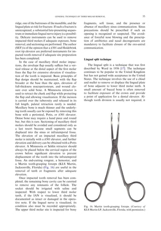 General Technique of Third Molar Removal | PDF