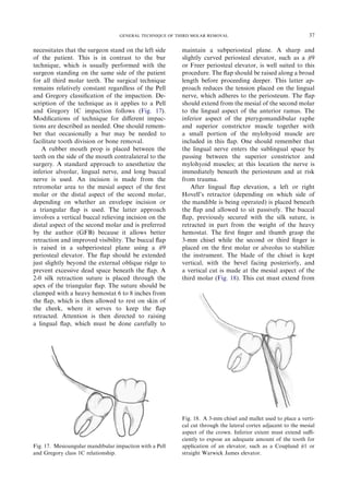 General Technique of Third Molar Removal | PDF