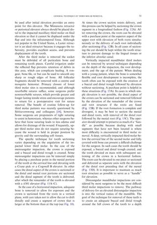 General Technique of Third Molar Removal | PDF