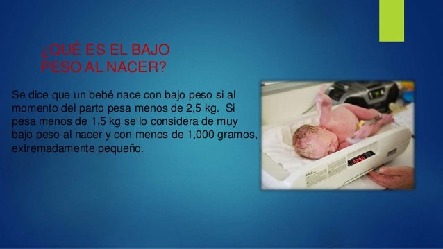 4.bajo peso al nacer