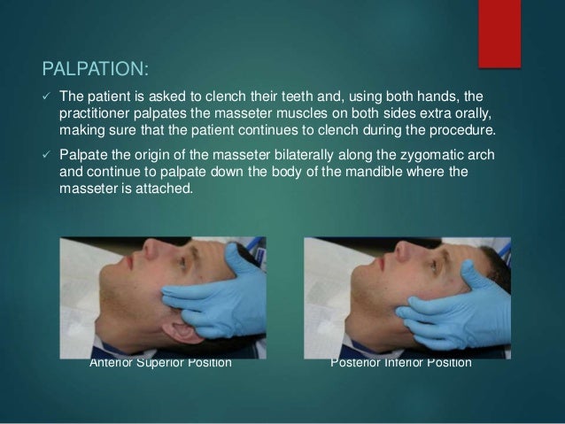 Muscles of Mastication