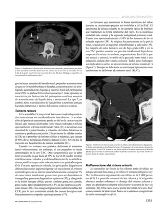 4. urotac[1] | PDF