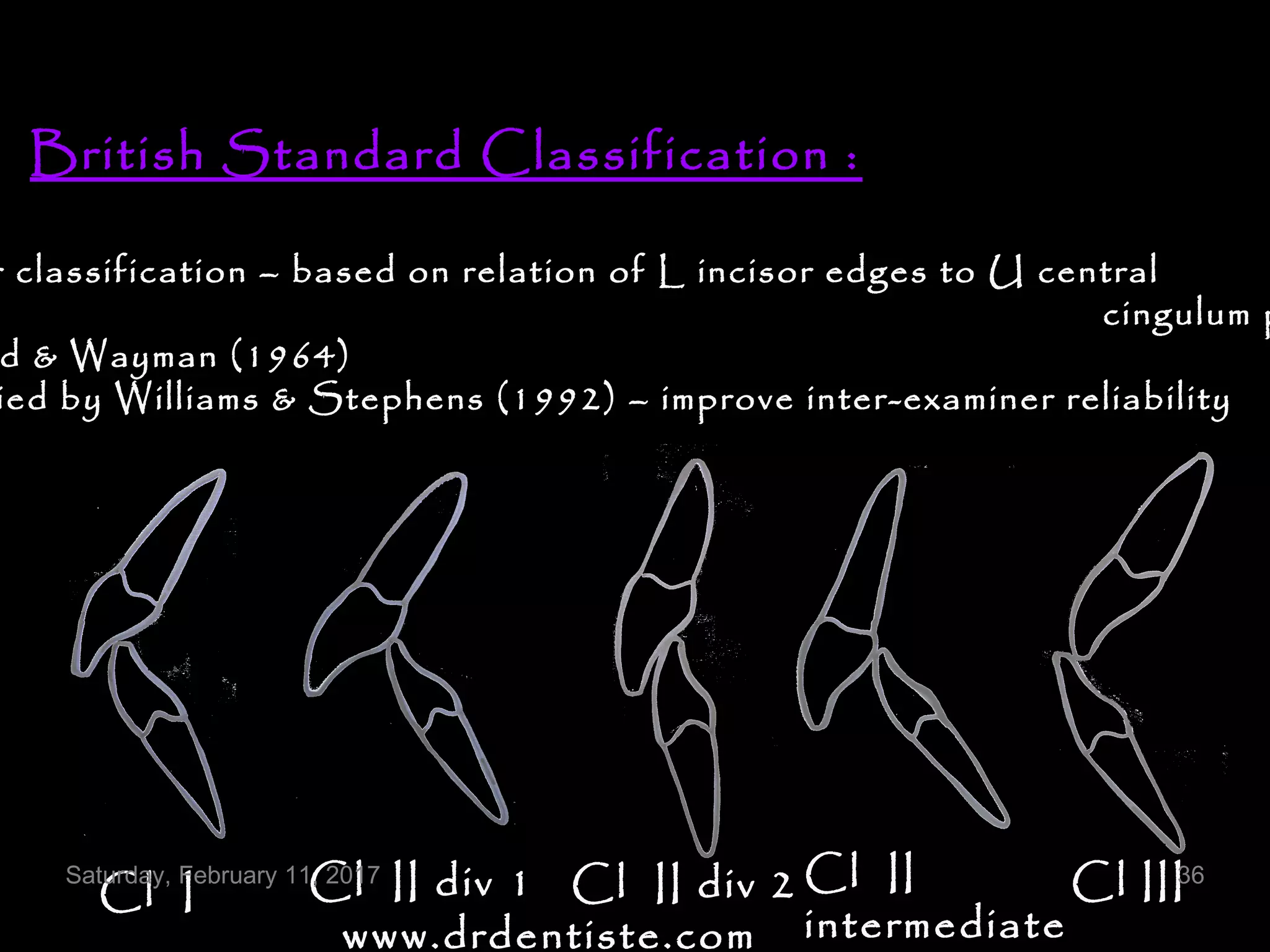 classification of malocclusion | PPT