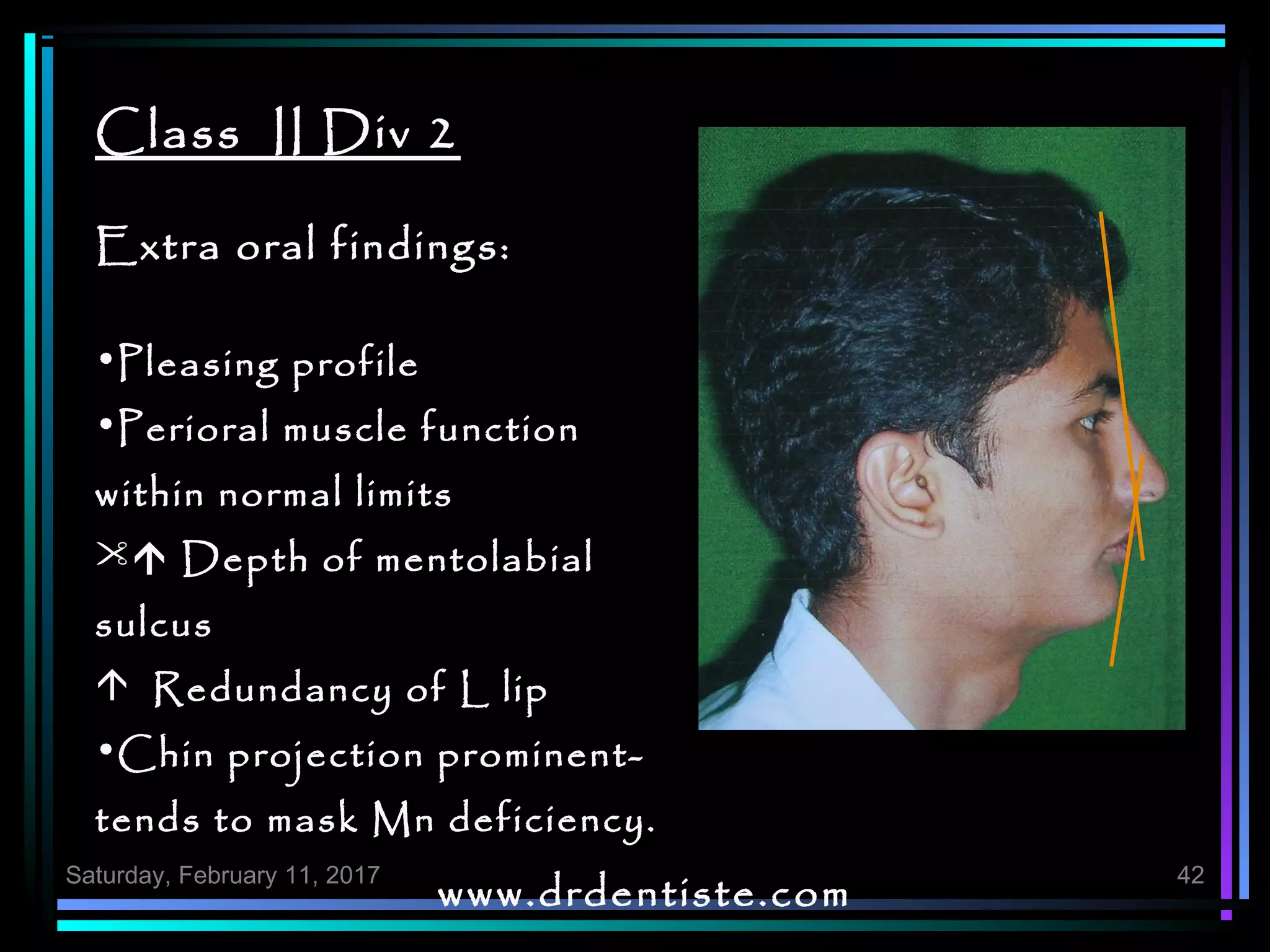 classification of malocclusion | PPT