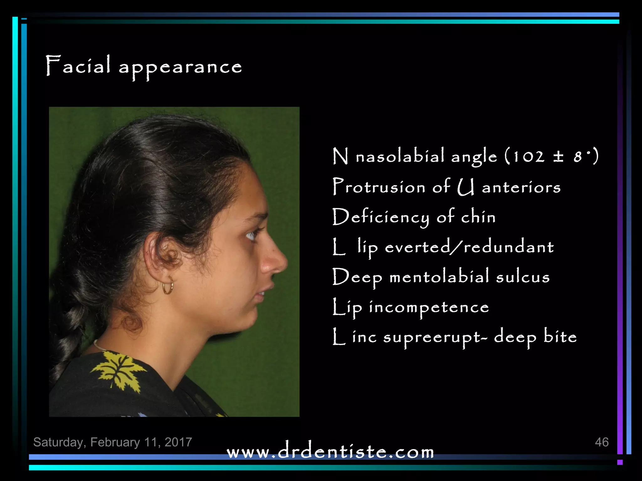 classification of malocclusion | PPT