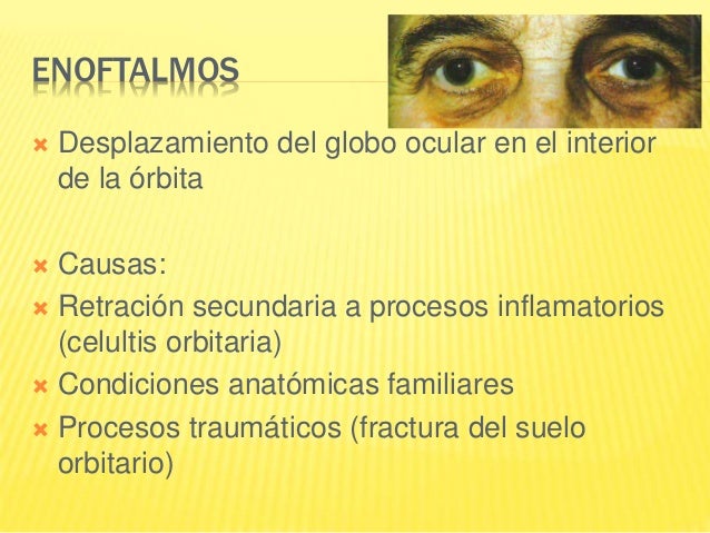 4. propedeútica ocular