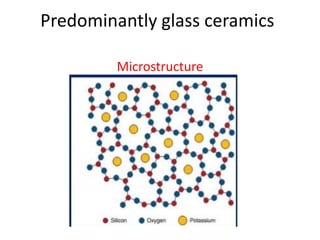 Dental ceramics (Composition,Microstructure and Applications) | PPTX