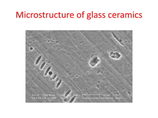 Dental ceramics (Composition,Microstructure and Applications) | PPTX