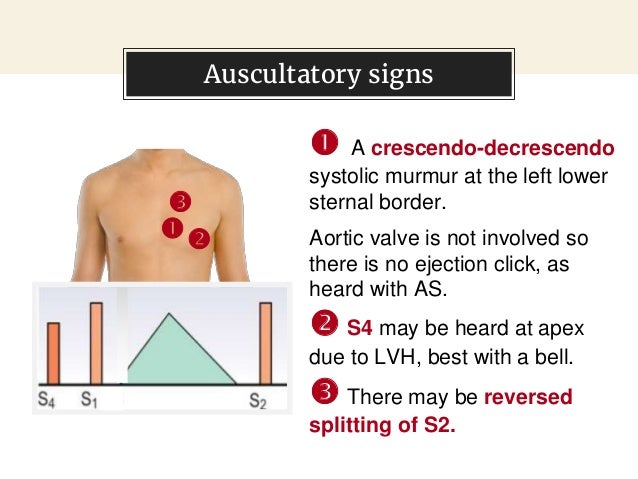 Cardiology 4.6. Hypertrophic Cardiomyopathy HCM - Dr. Farjad Ikram
