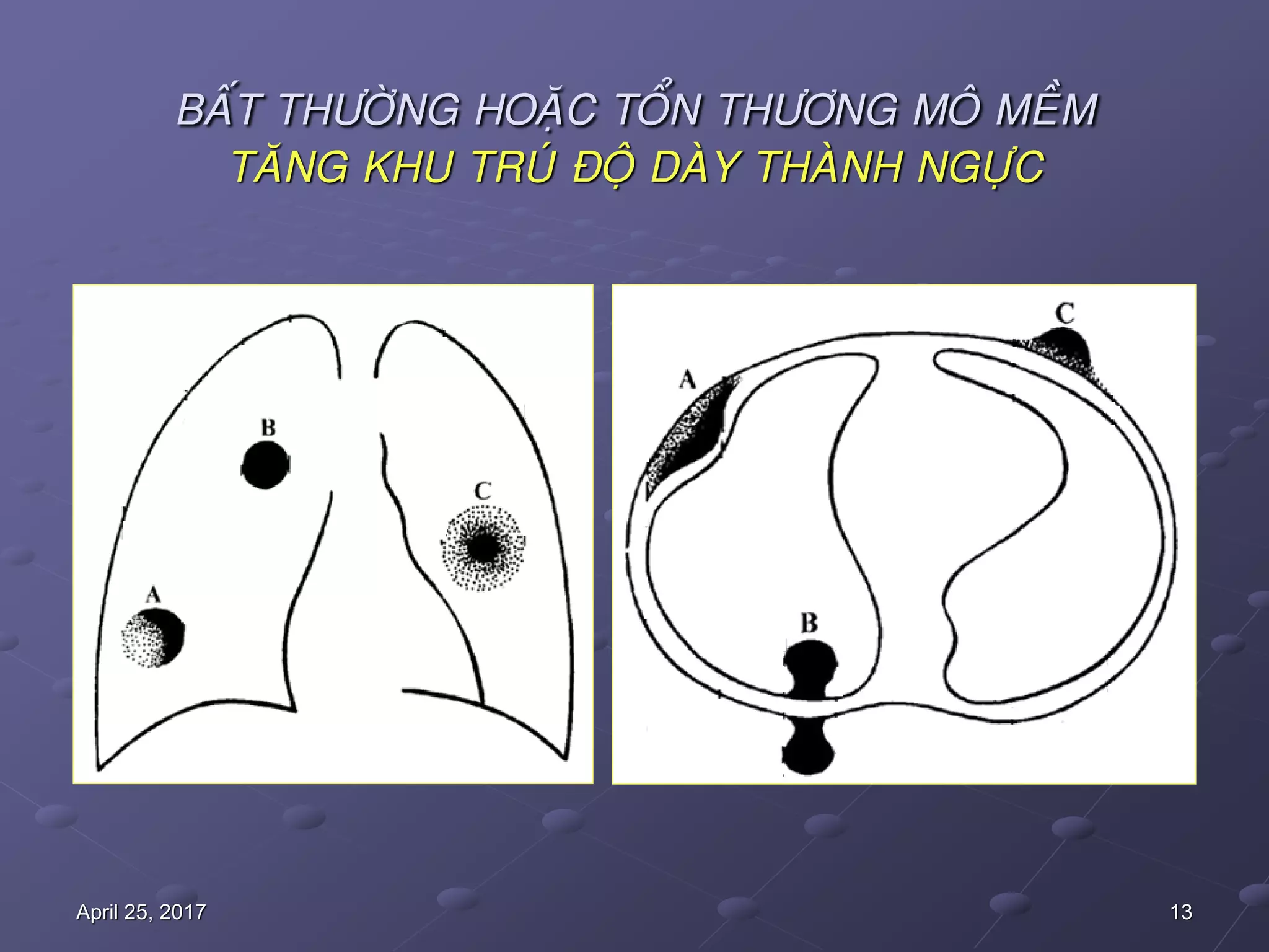 4. Parietal Syndrome | PPT
