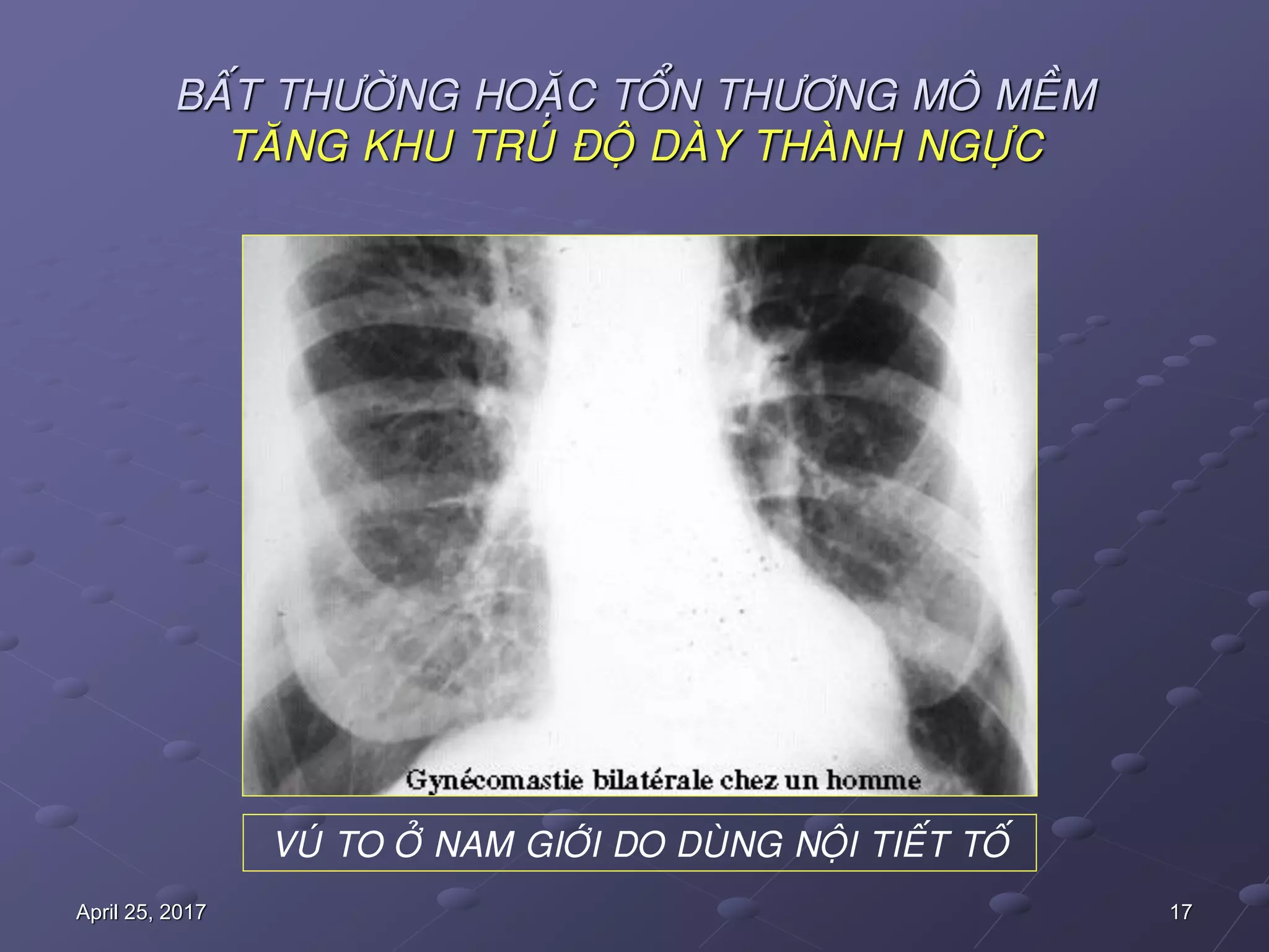 4. Parietal Syndrome | PPT