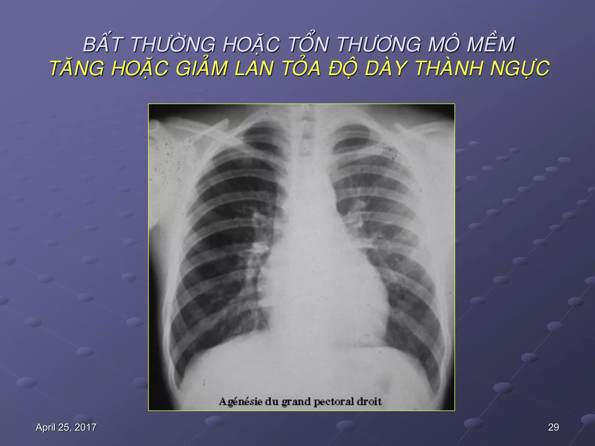 4. Parietal Syndrome | PPT