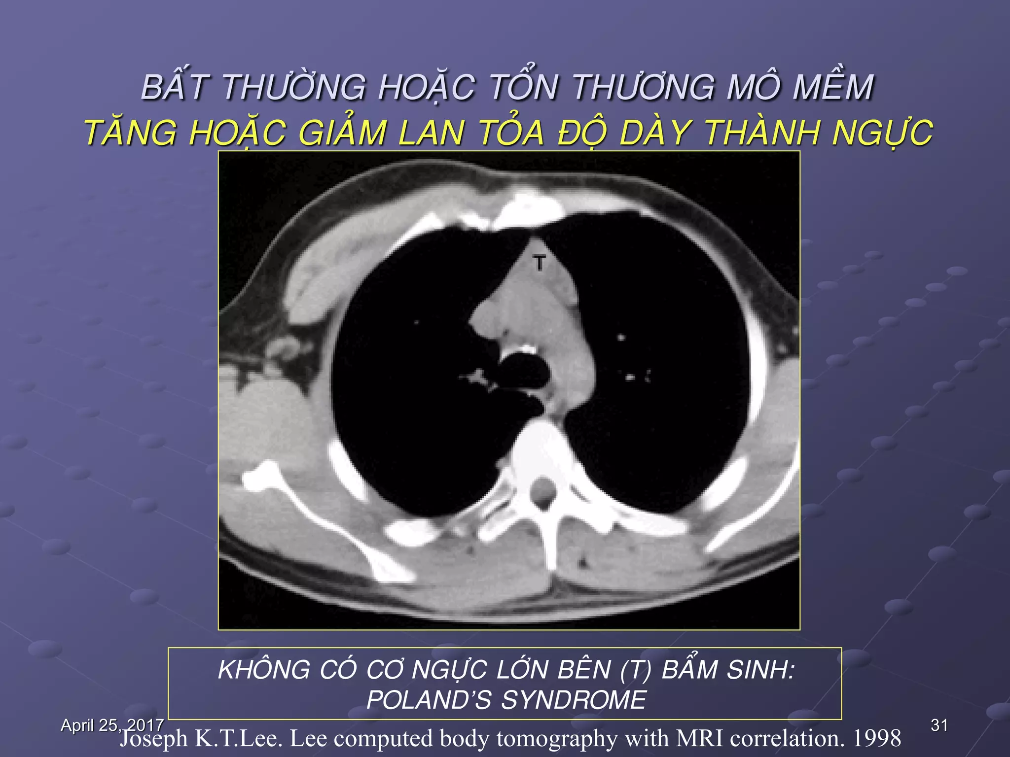 4. Parietal Syndrome | PPT