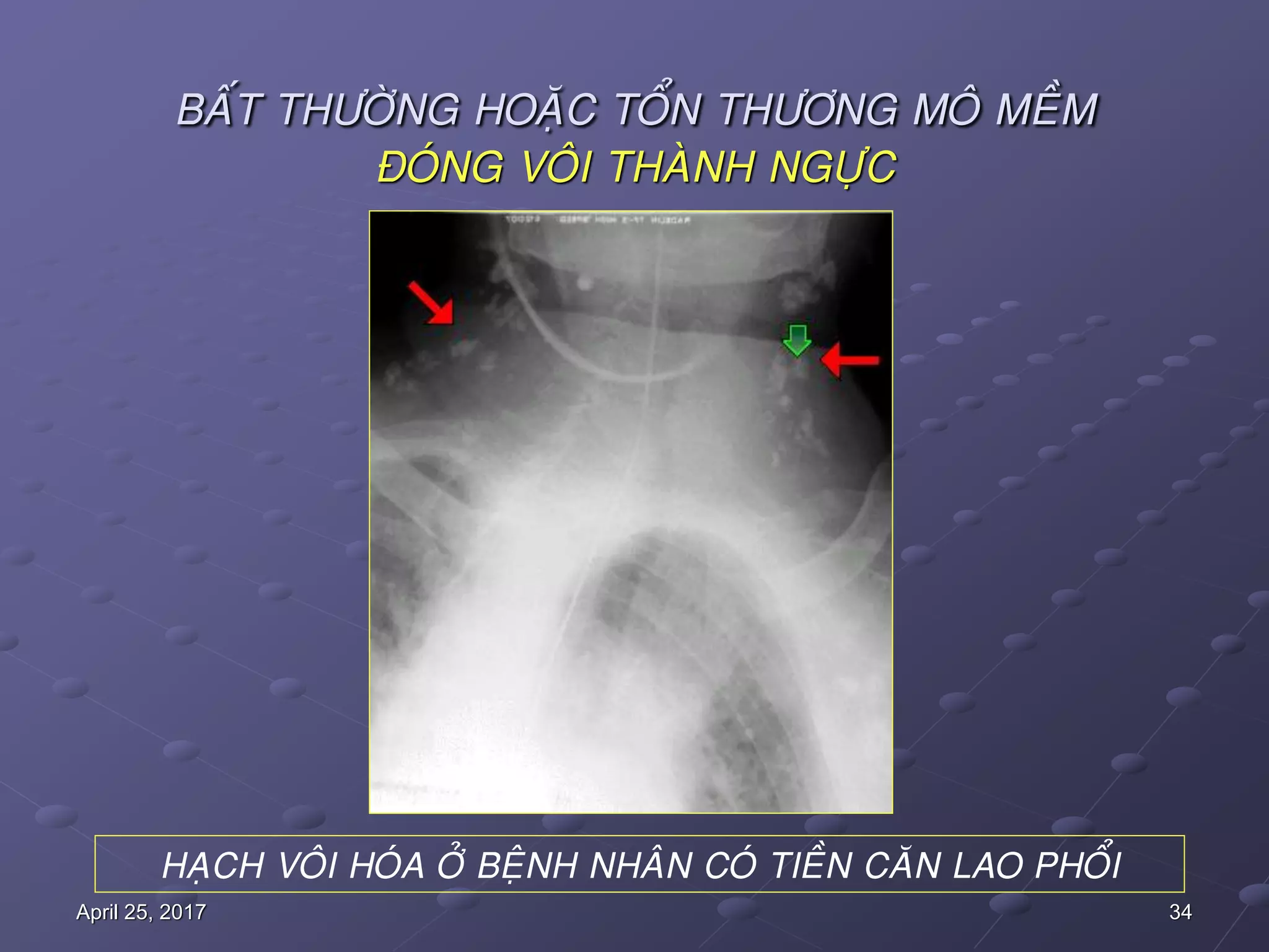 4. Parietal Syndrome | PPT