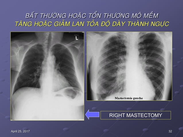 4. Parietal Syndrome | PPT