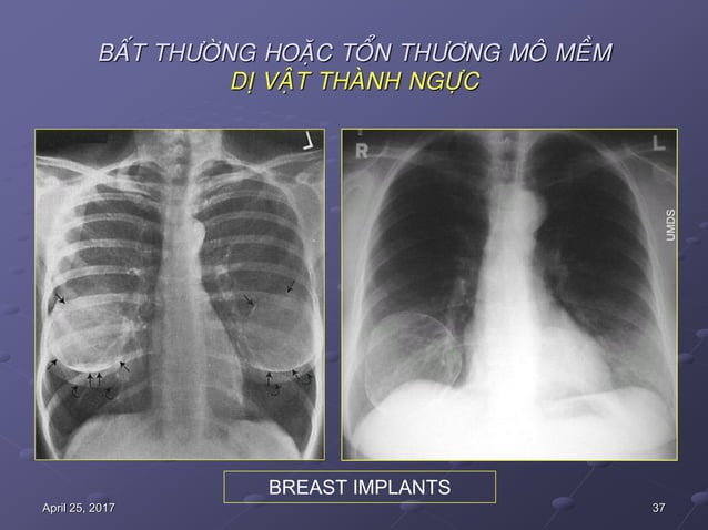 4. Parietal Syndrome | PPT