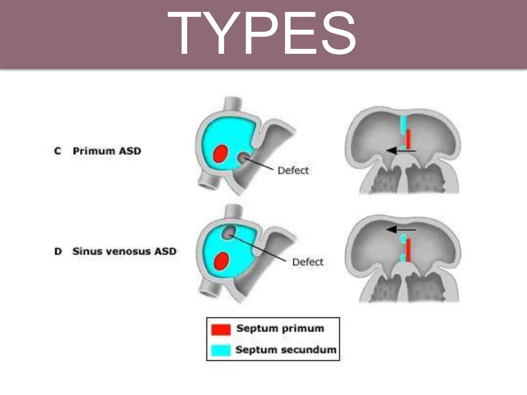 Congenital heart diesease- presenatation.pdf
