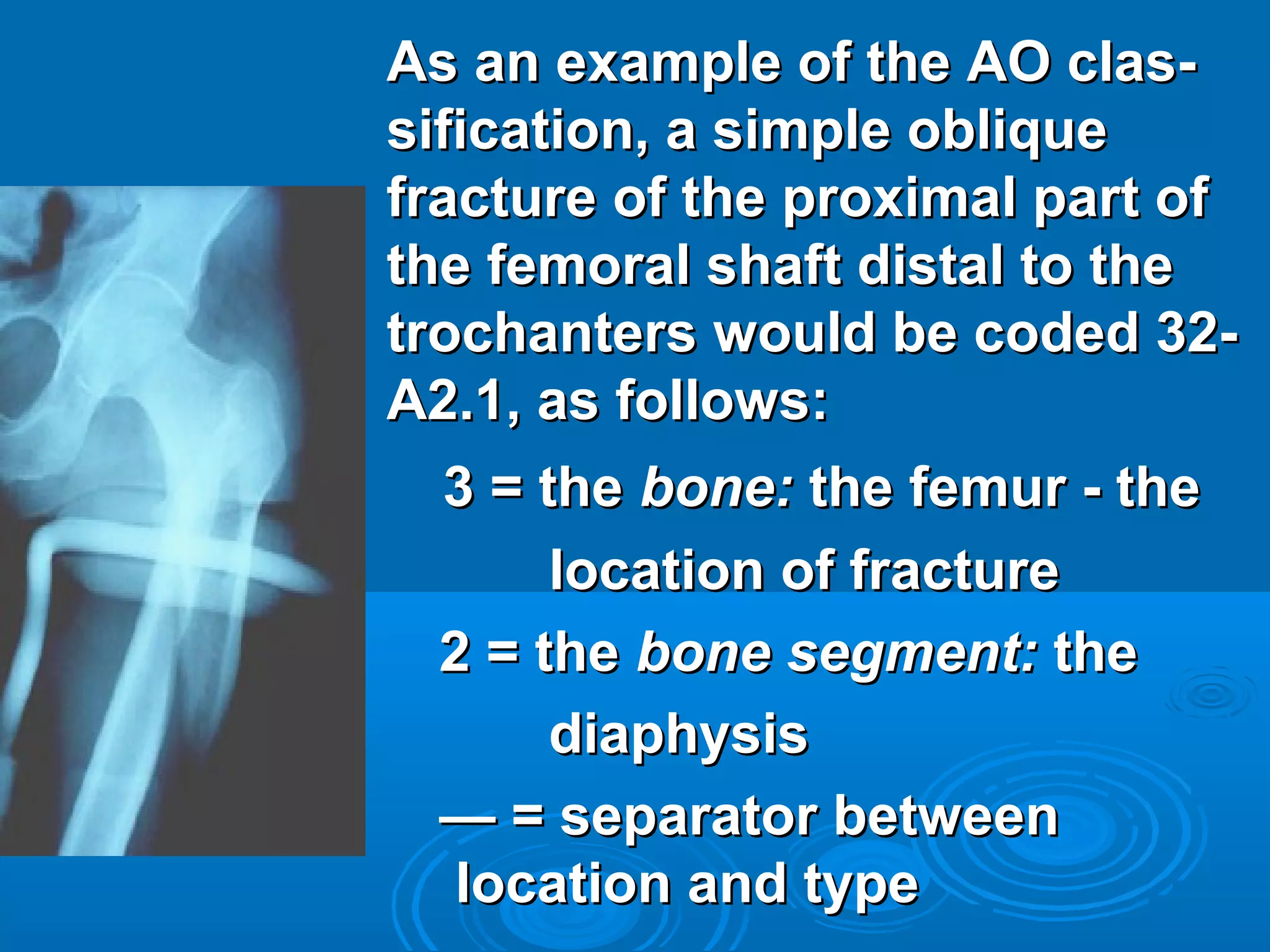 Management of Fractures | PPT