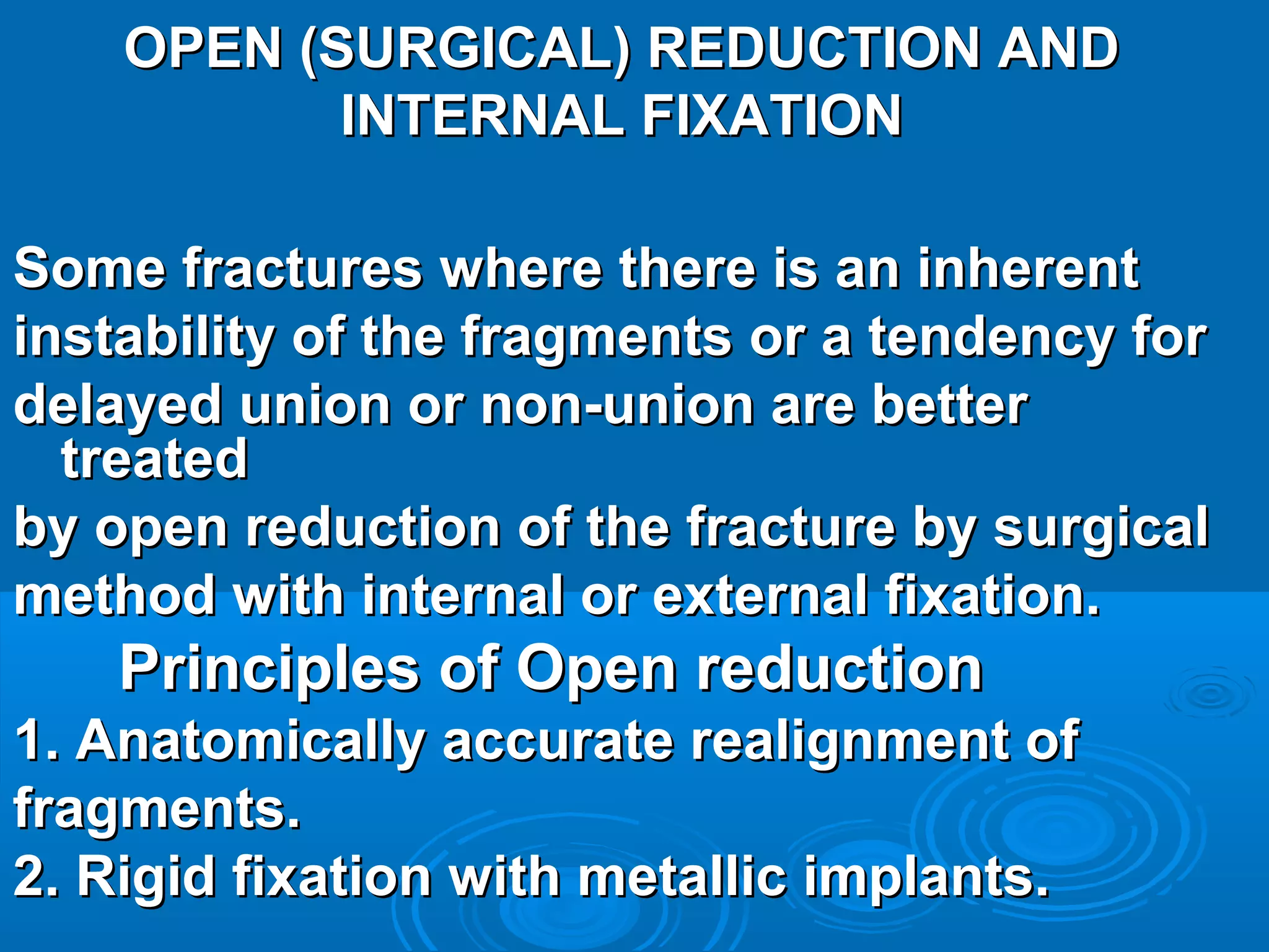 Management of Fractures | PPT