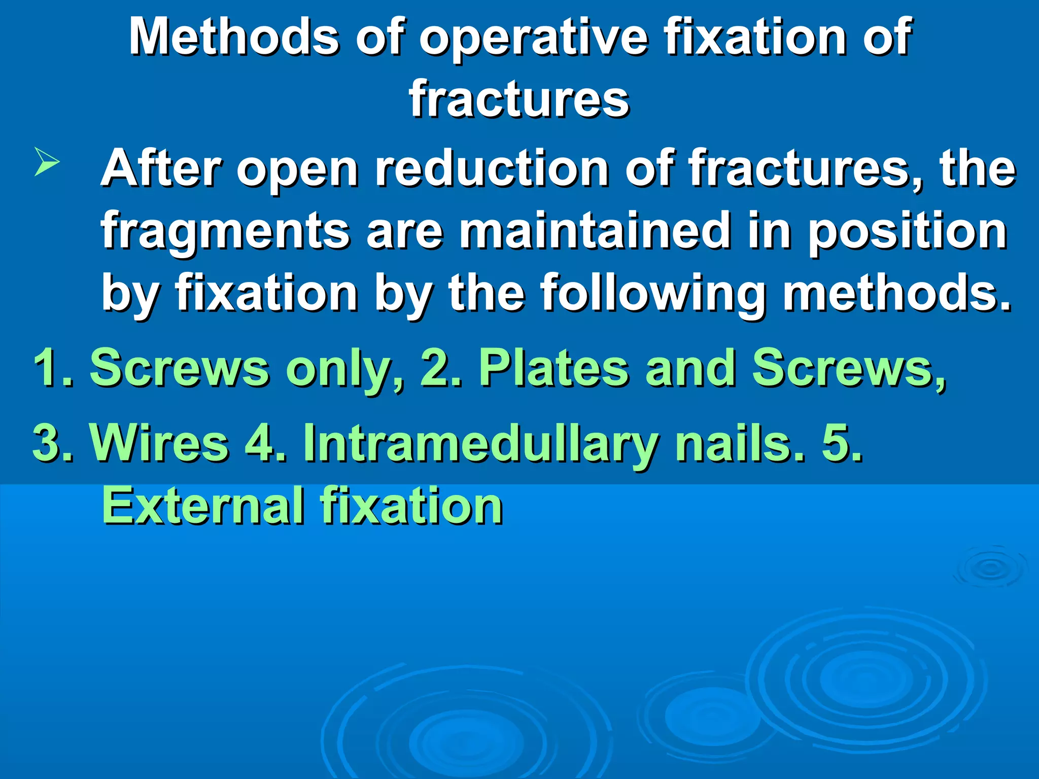 Management of Fractures | PPT