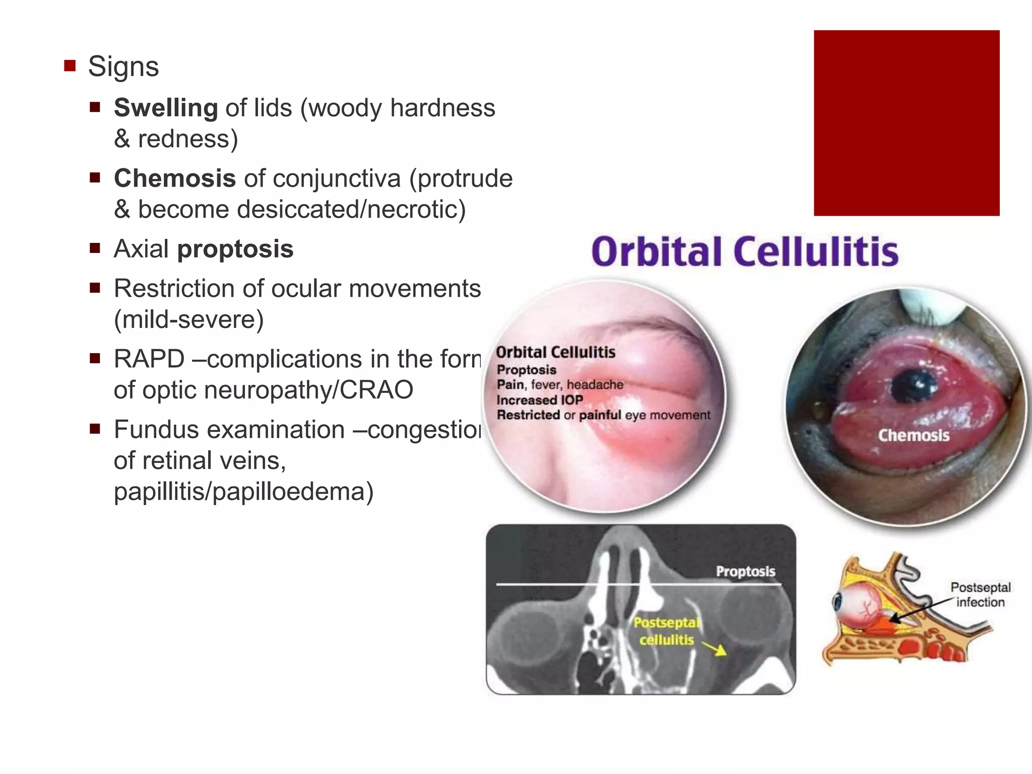 orbital cellulitis | PPTX