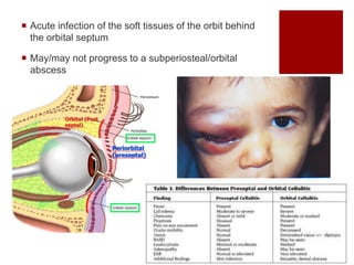 orbital cellulitis | PPTX