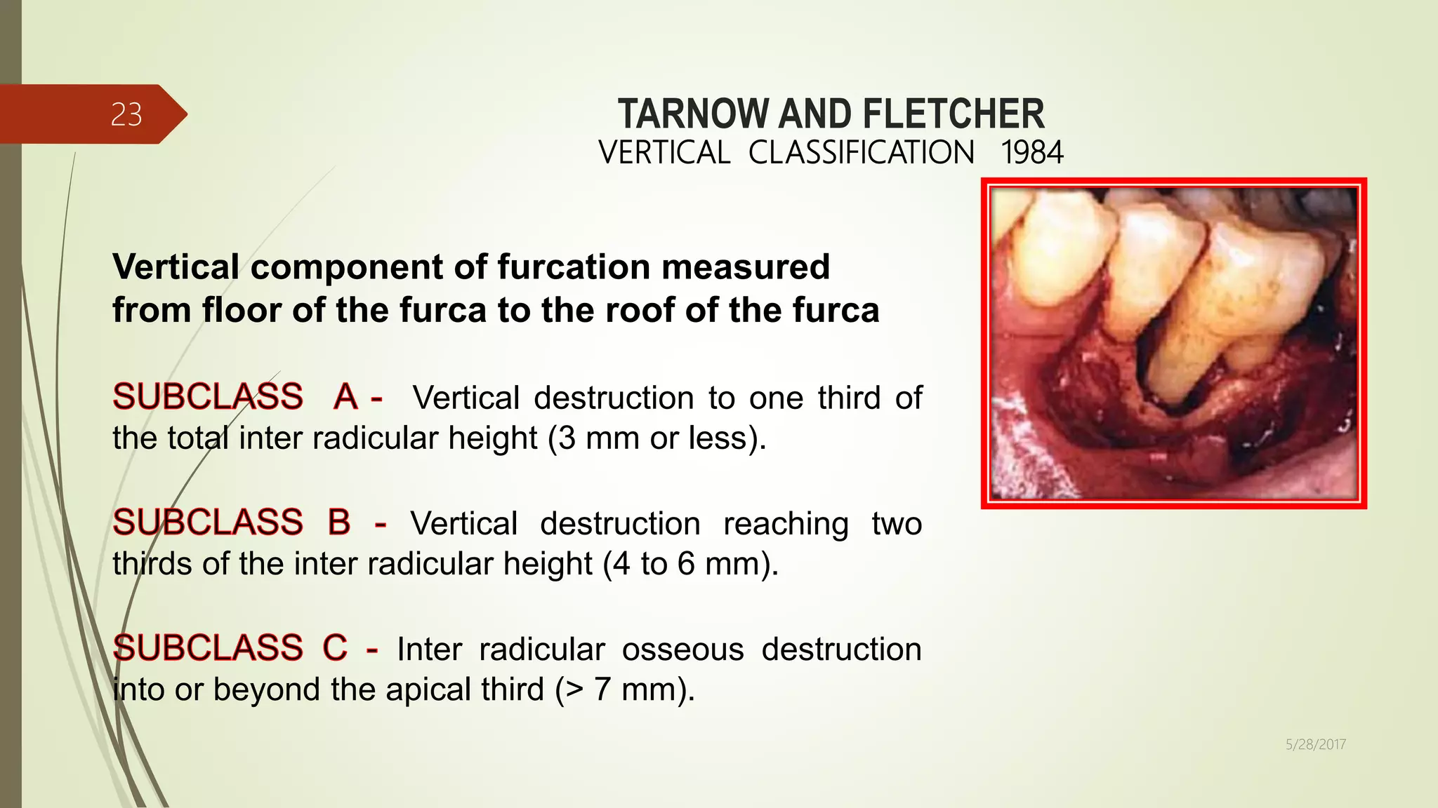 4.furcation involvement and its treatment | PPTX