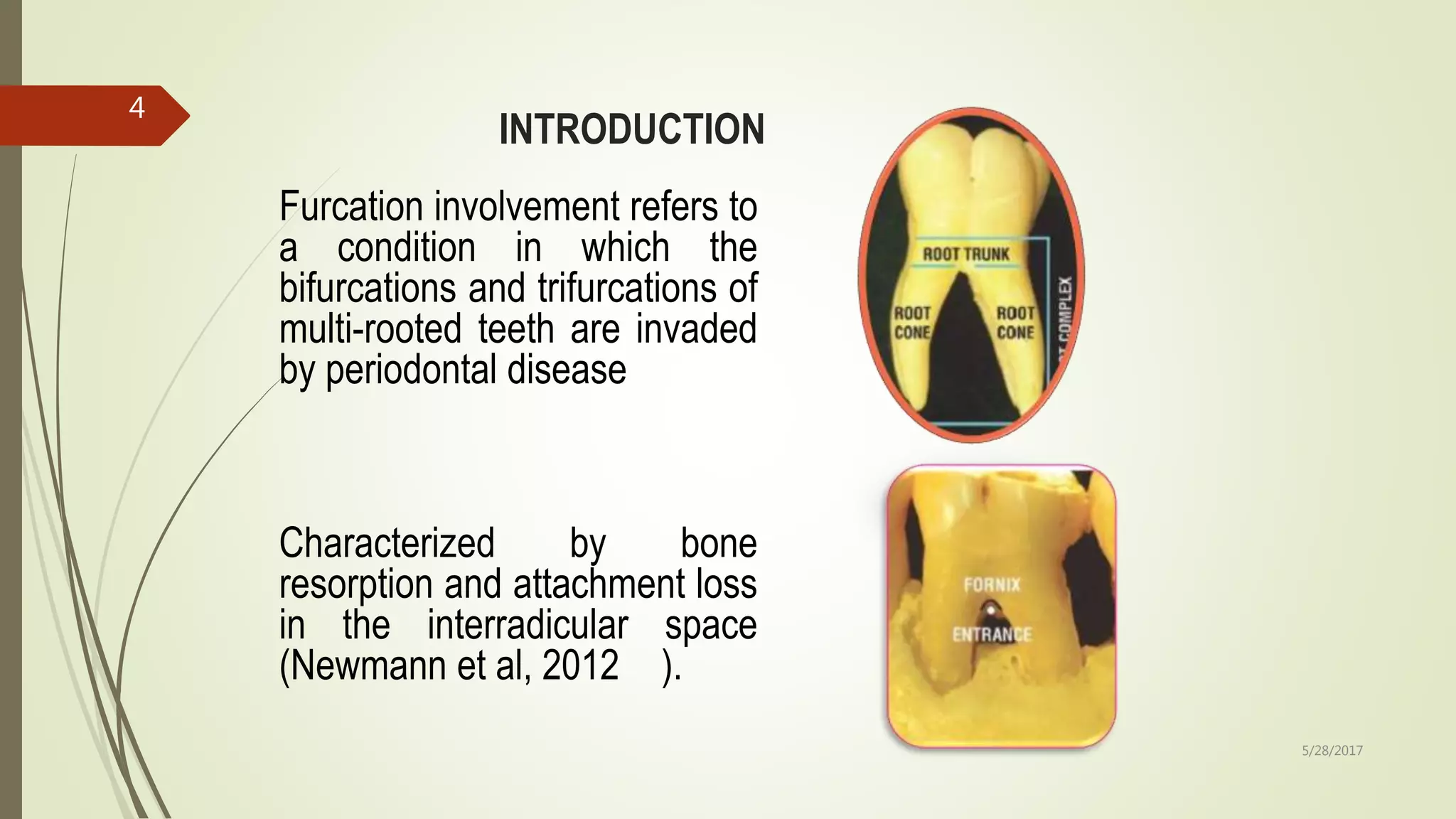 4.furcation involvement and its treatment | PPTX