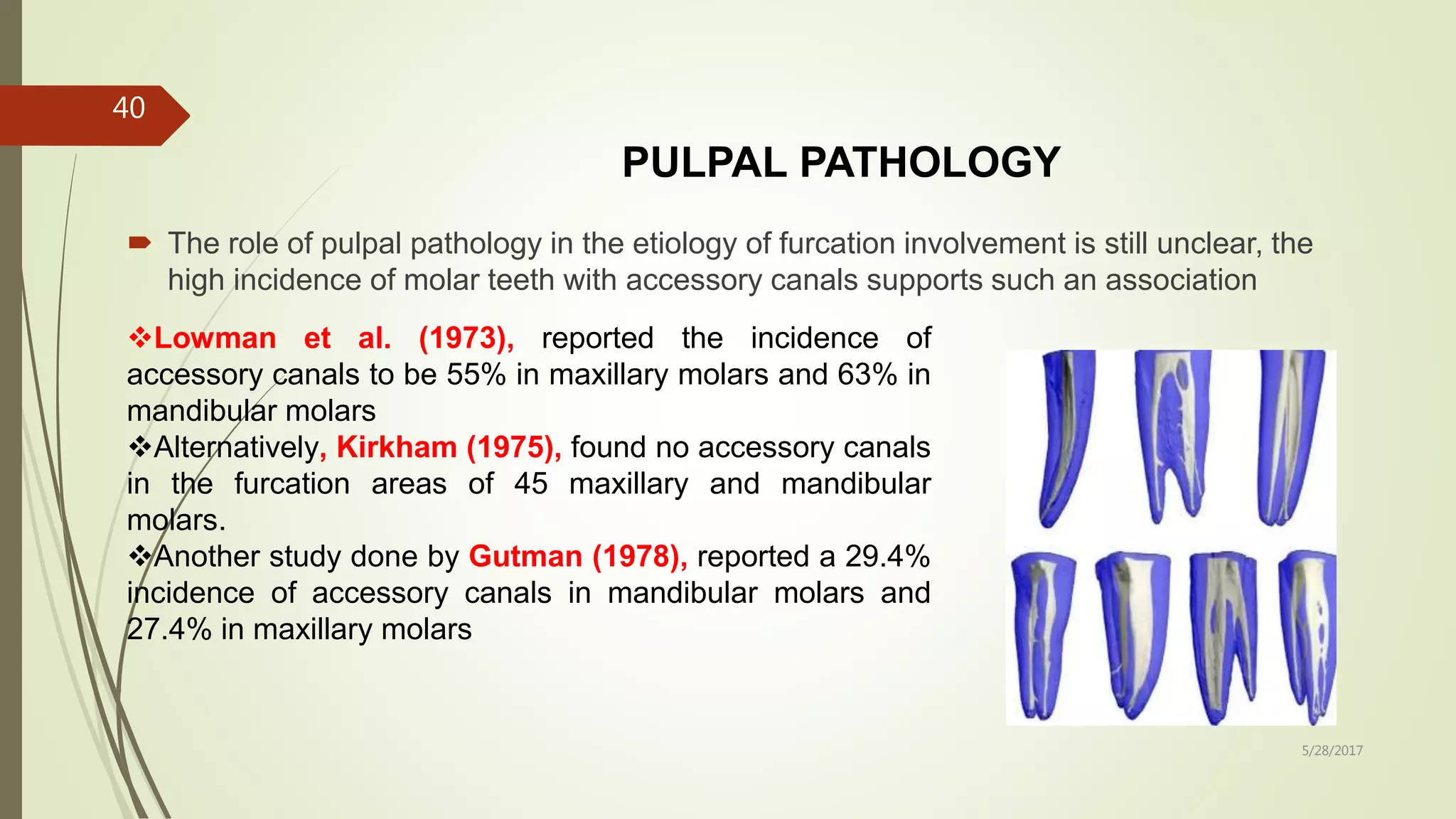 4.furcation involvement and its treatment | PPTX