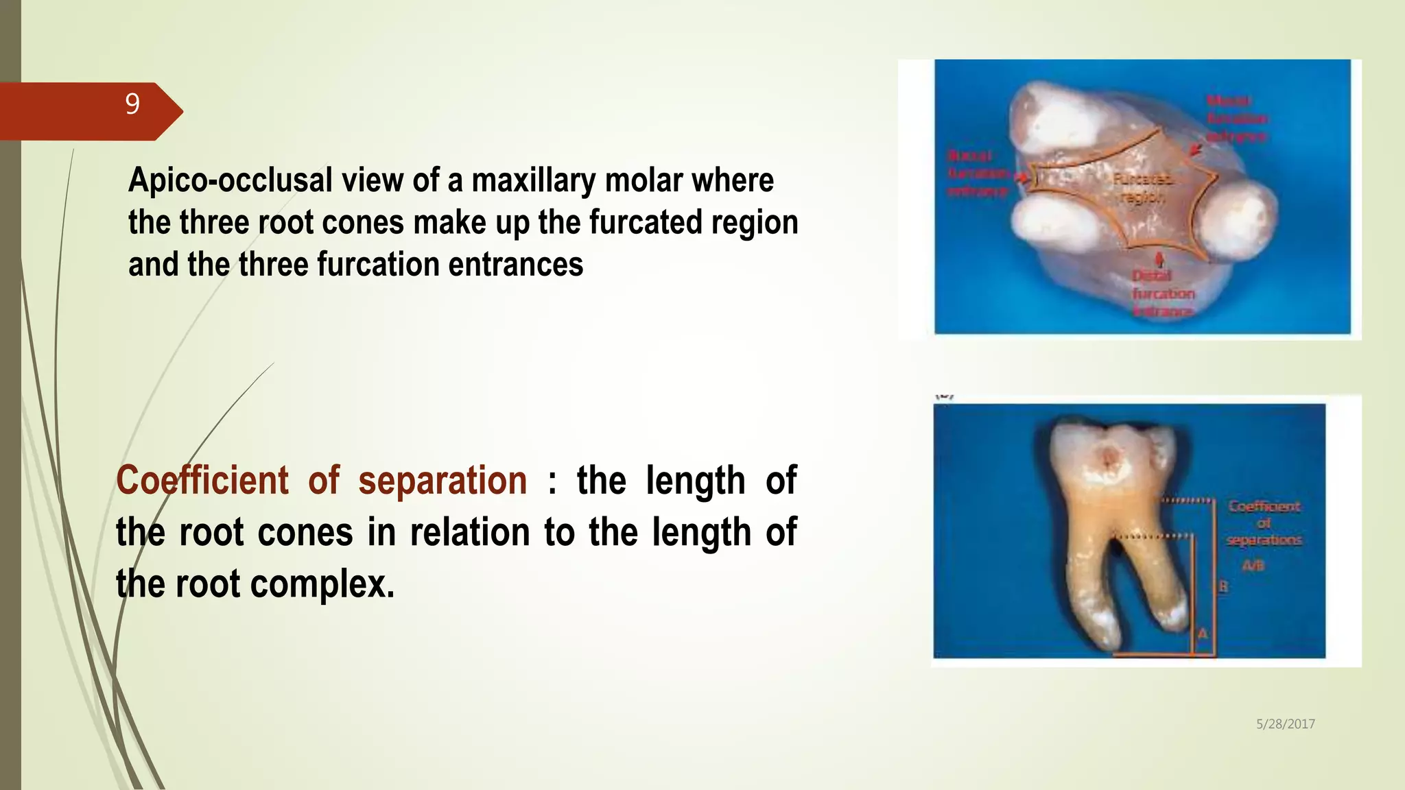 4.furcation involvement and its treatment | PPTX