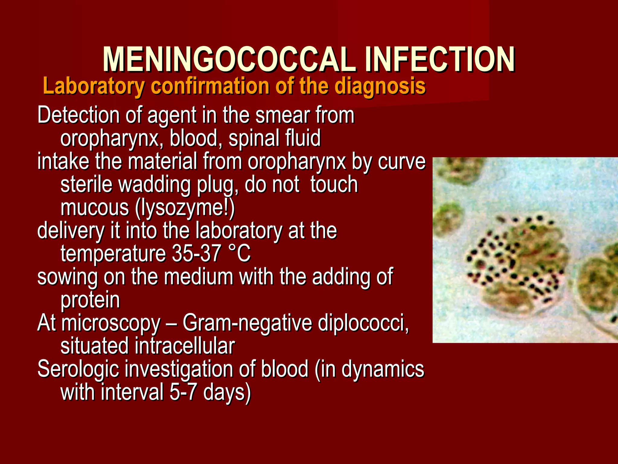 Epidemiology of Respiratory Tract Infections. Influenza, Diphtheria ...